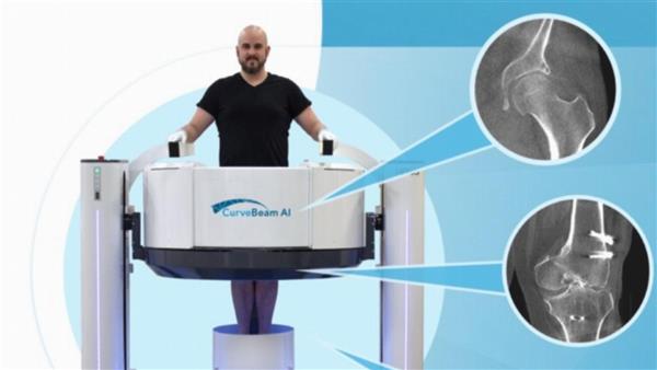 CurveBeam AI (ASX:CVB) makes ASX debut after heavily supported $25m IPO ...